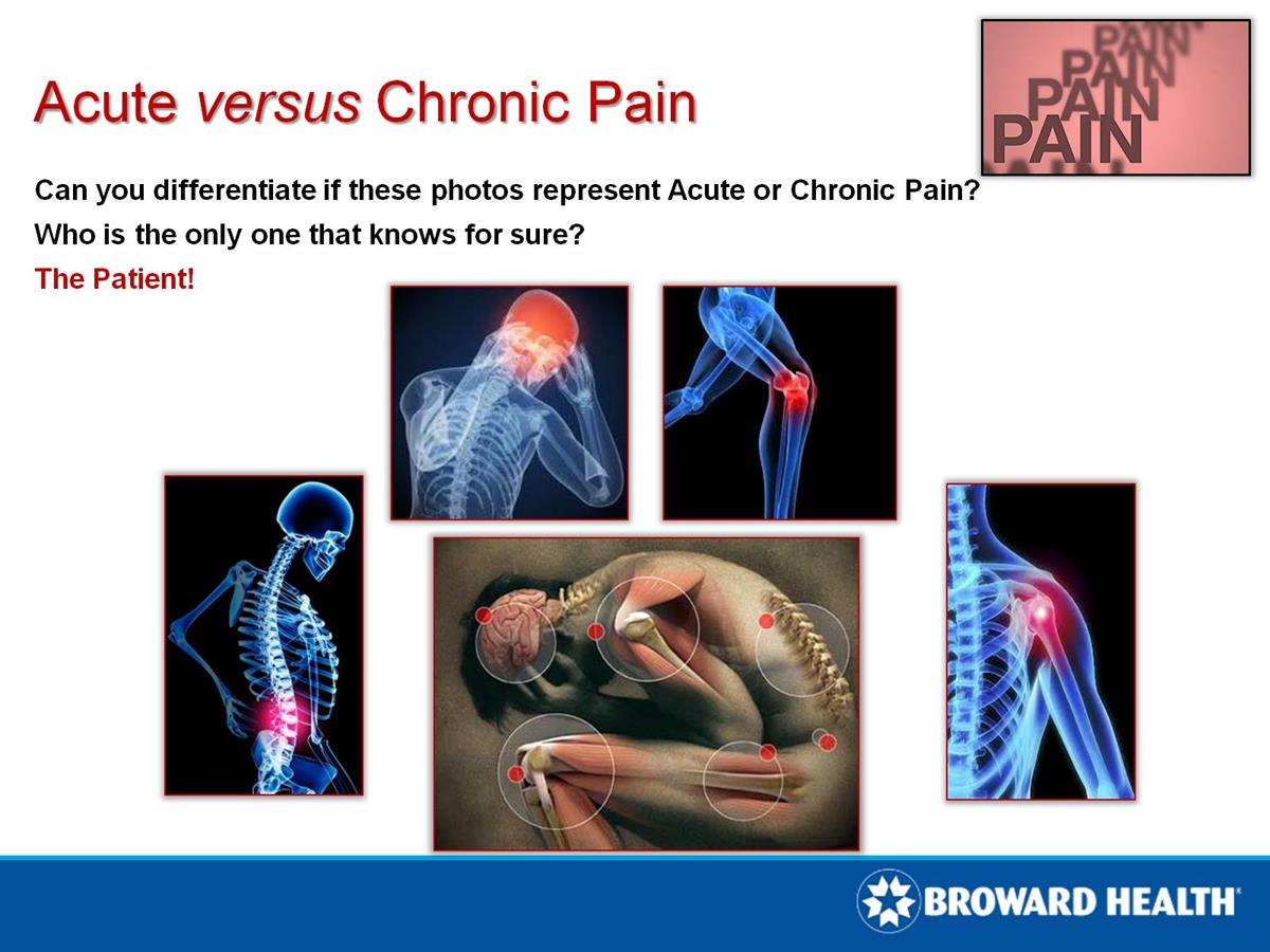 Acute versus Chronic Pain